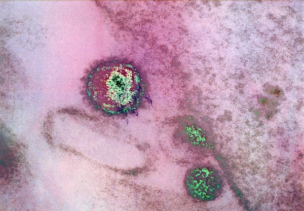 Infection à VIH. Agent pathogène - Base de données EFICATT - INRS