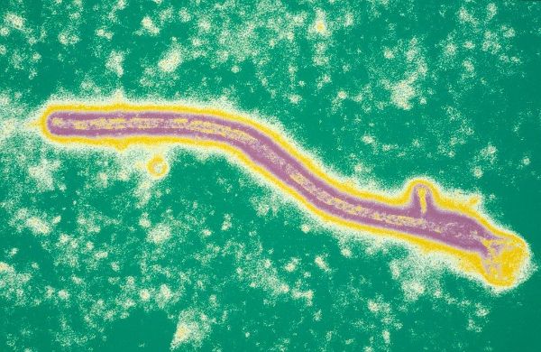 Maladie à virus Ebola (MVE). Agent pathogène - Base de données EFICATT ...