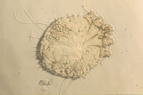 Gale. Agent pathogène - Base de données EFICATT - INRS