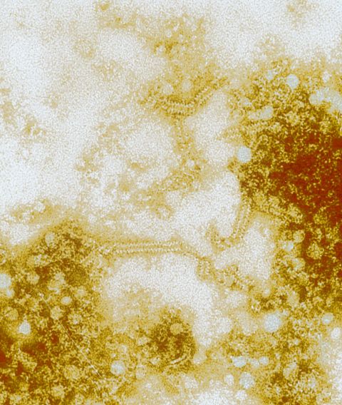 Oreillons. Agent pathogène - Base de données EFICATT - INRS