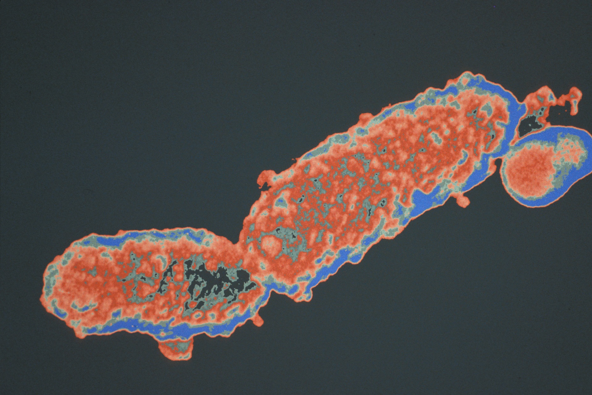 Coqueluche. Agent pathogène - Base de données EFICATT - INRS
