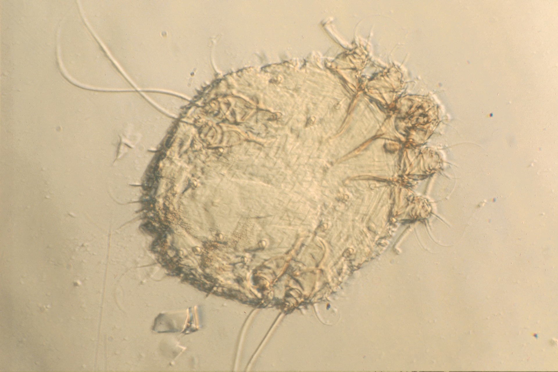 Gale. Agent pathogène - Base de données EFICATT - INRS