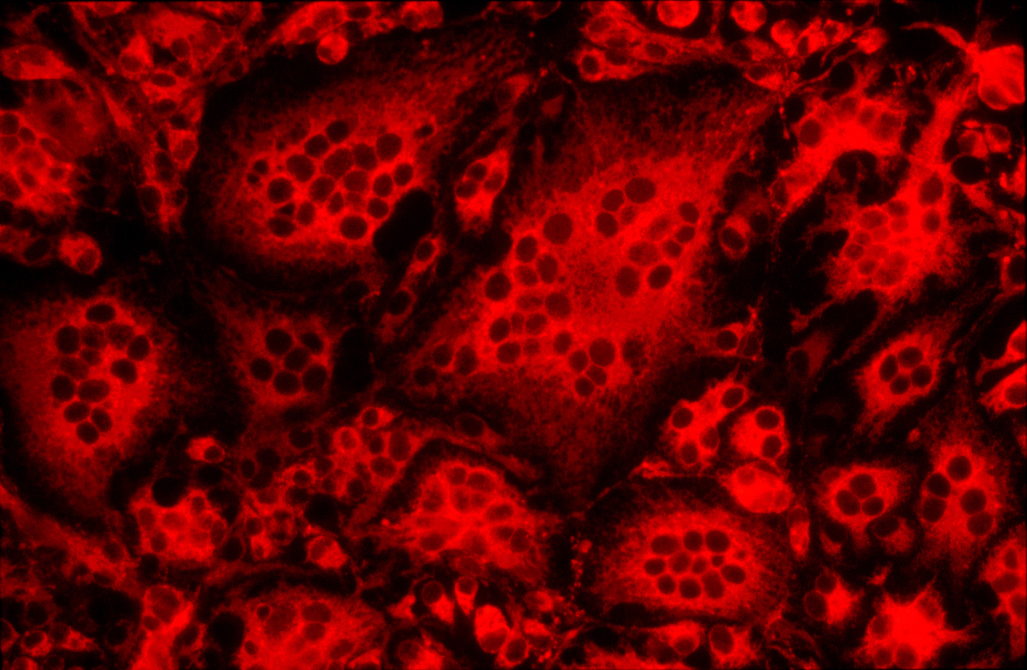 Rougeole. Agent pathogène - Base de données EFICATT - INRS