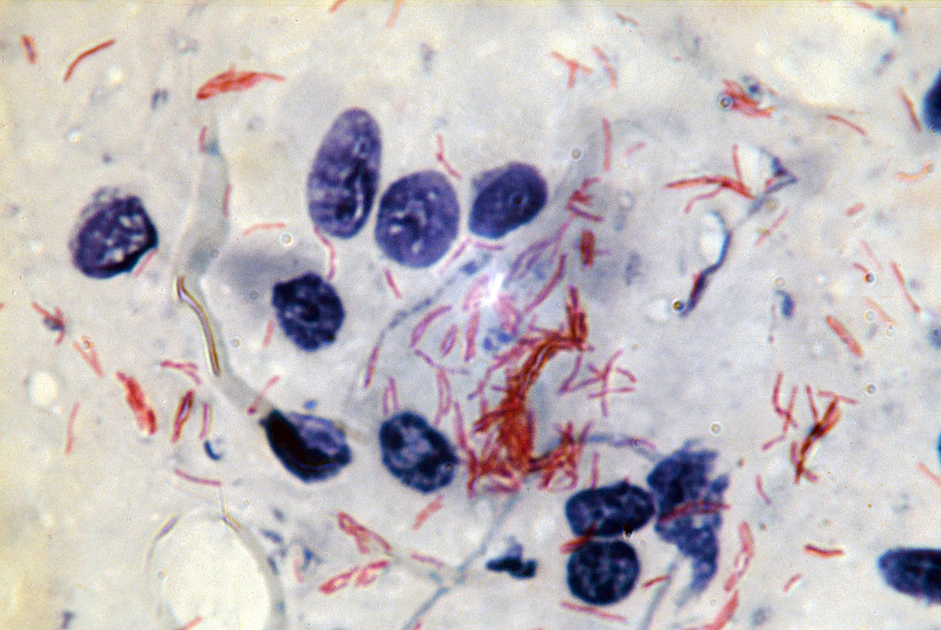 Tuberculose. Agent pathogène - Base de données EFICATT - INRS