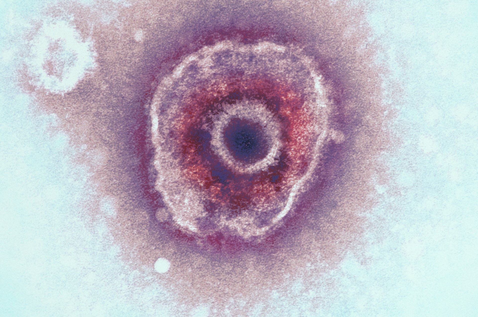 Varicelle - Zona. Agent pathogène - Base de données EFICATT - INRS